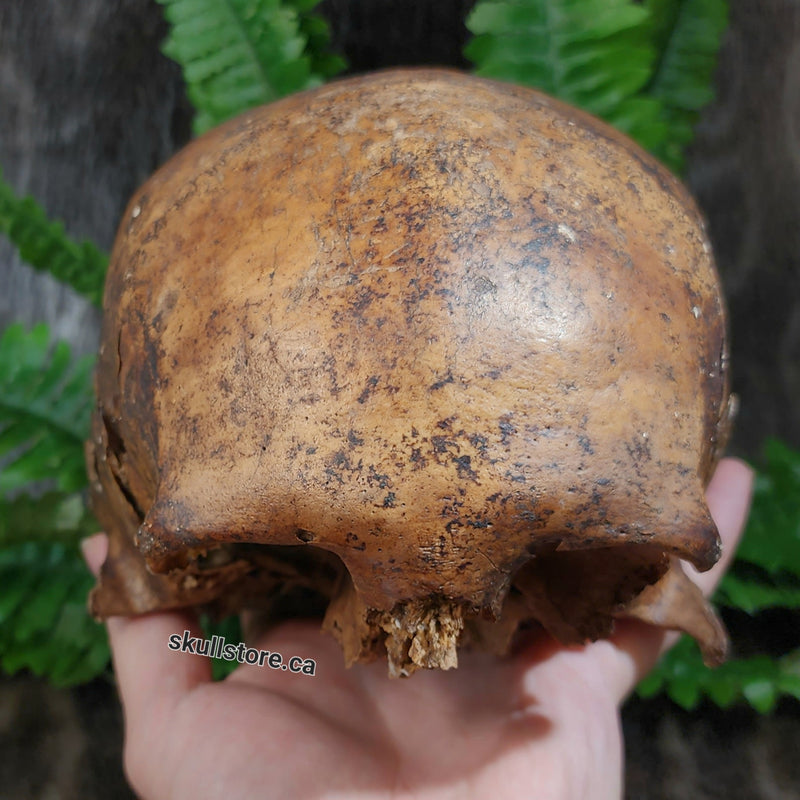 SkullStore // Buy Real Medical Human Skulls, Bones, Skeletons Online ...